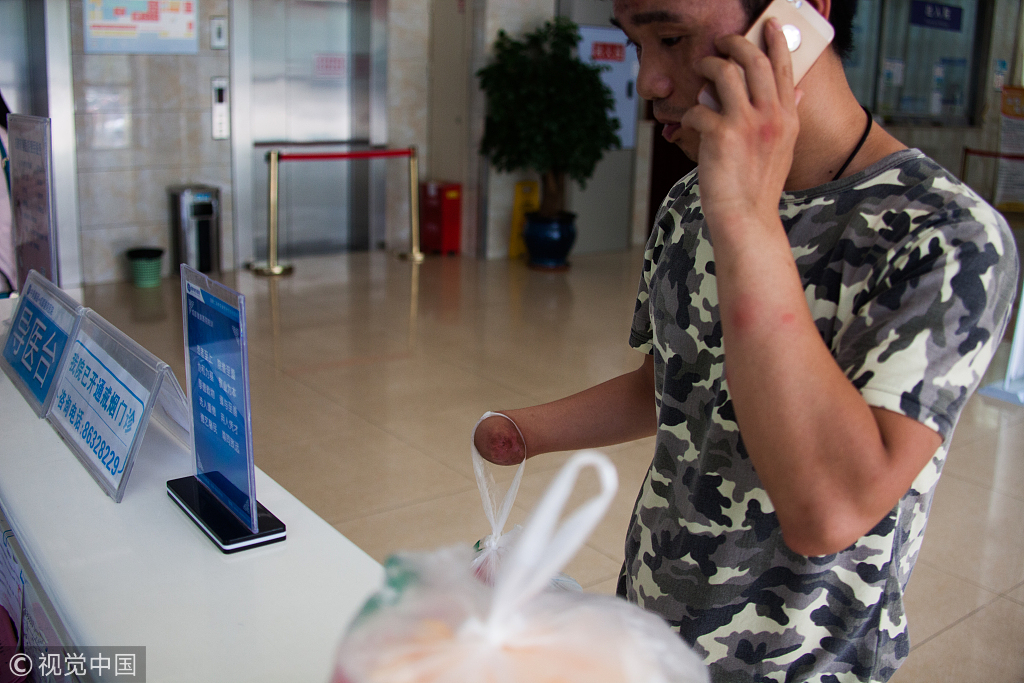 Food delivery app creates new functions to assist disabled staff ...