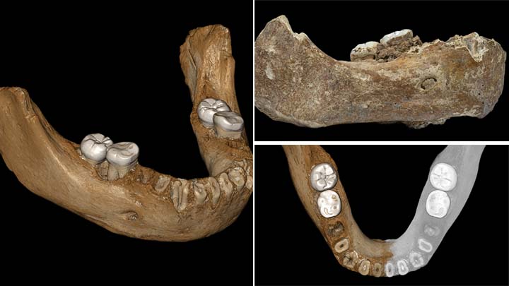 160,000-year-old Denisovan mandible discovered in Tibet Plateau, China ...